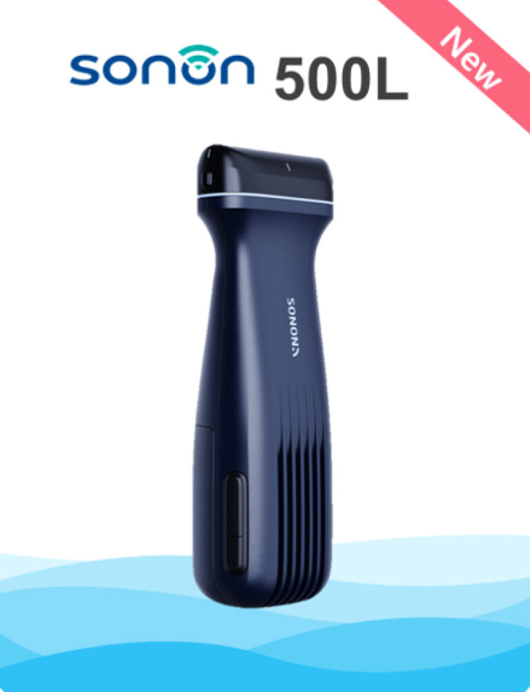 Sonon 500L | Wireless Handheld Ultrasound - Spec Brite Group